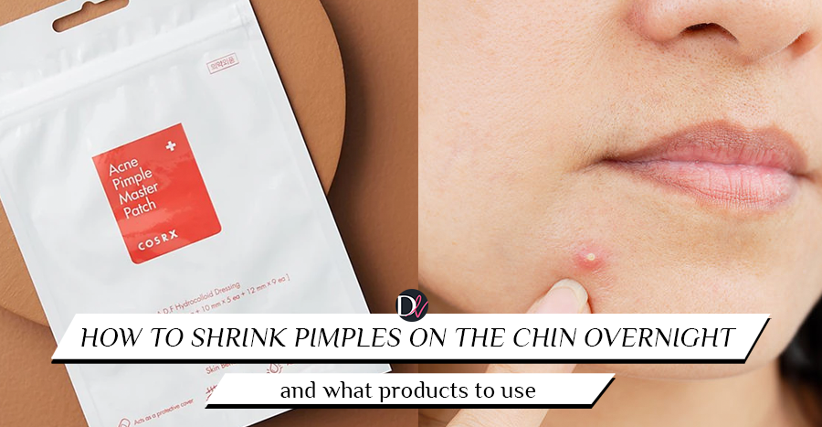 Pimples on the chin: types, causes, and 7 products to eliminate them