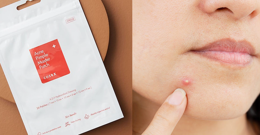 Pimples on the chin: types, causes, and 7 products to eliminate them