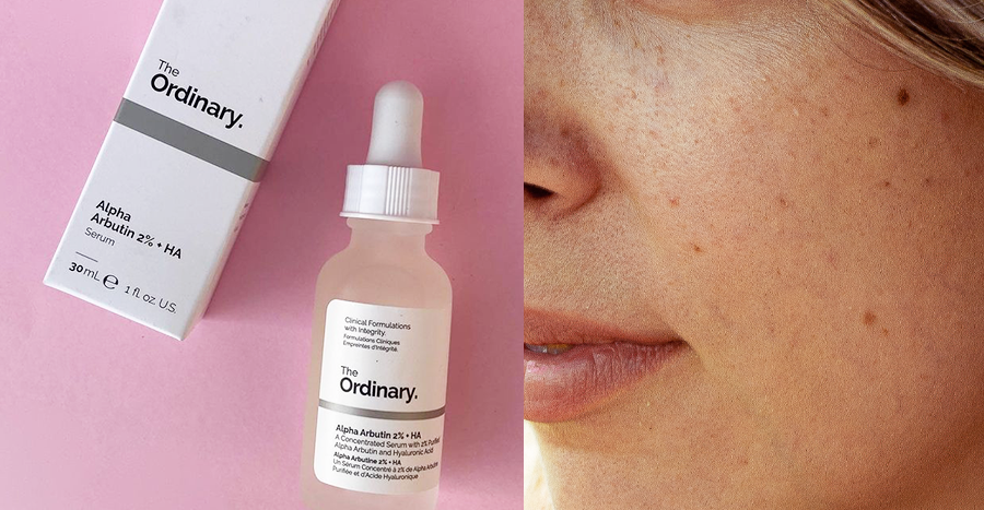 Alpha arbutin for skin: Benefits, functions, & review