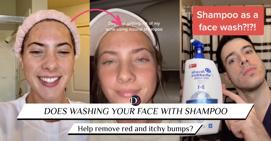 Washing your face with shampoo gets rid of facial fungus?! Hear us out