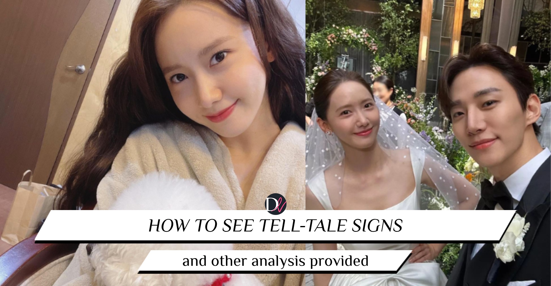 Yoona Plastische Chirurgie Did King The Land's YoonA Undergo Cosmetic