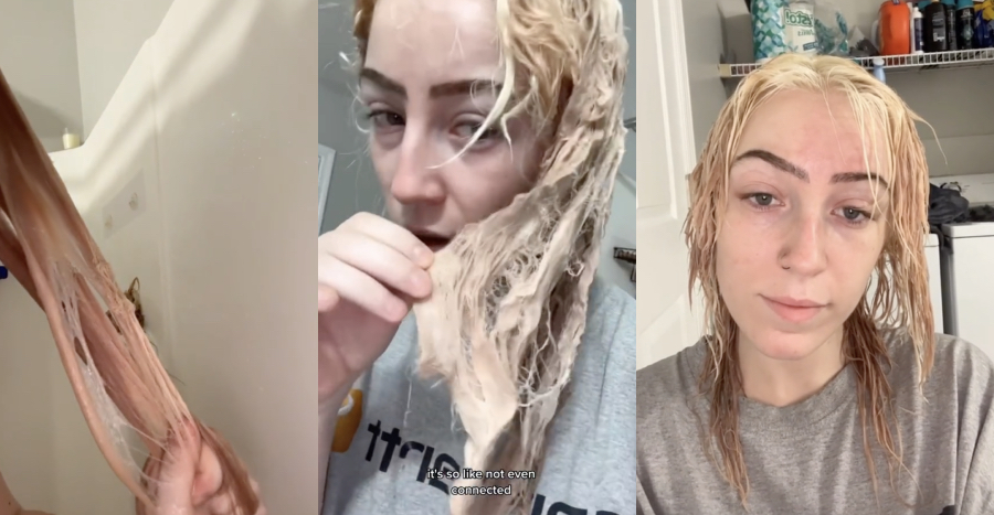 DIY bleaching made woman lose most of her hair; she emotionally broke ...