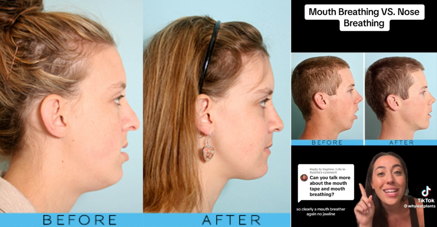 How you breathe can change your face shape drastically; here's ...
