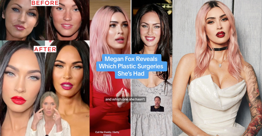 Megan Fox's Plastic Surgery Confession: Dealing With Body Dysmorphia ...